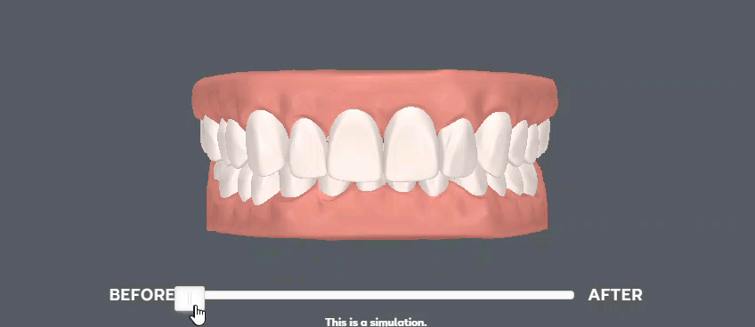 Treatable Cases - DreamSmile Labs